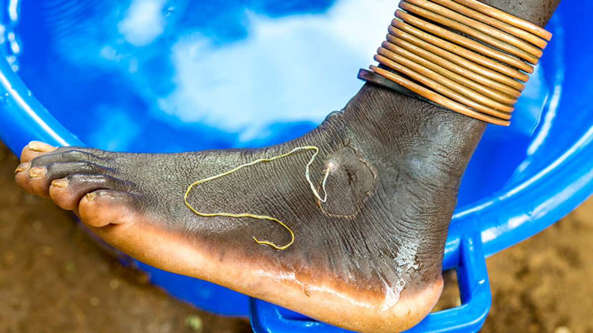 Center-led Guinea Worm Eradication Program Wins Prestigious Prize from ...