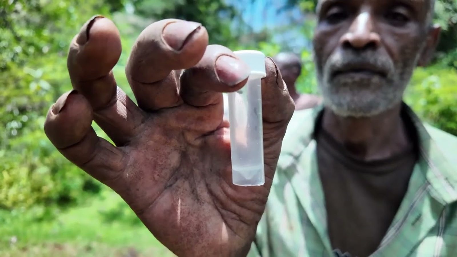 Guinea Worm Disease Reaches All-Time Low: Only 10 Human Cases Reported ...